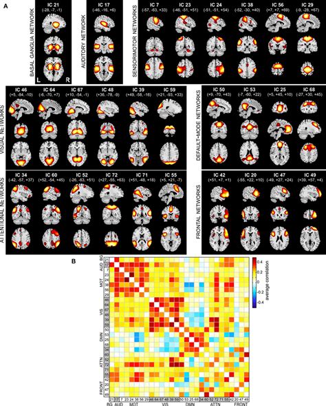 Functional Connectivity Within And Between Rsns A Sms Of The 28