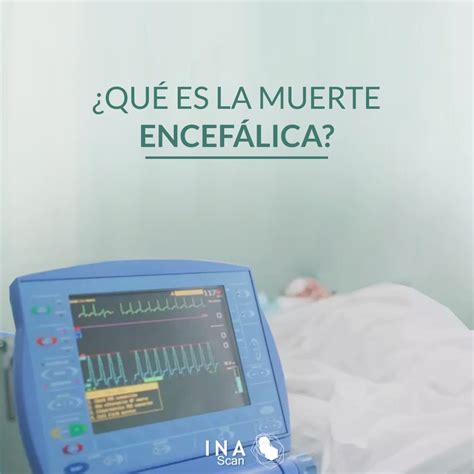 ¿qué Es La Muerte Encefálica La Muerte Encefálica Se Produce Cuando