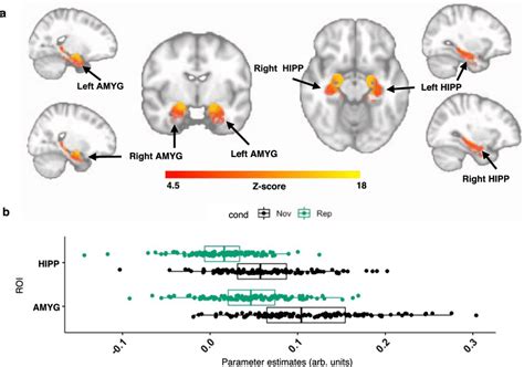 Voxel Wise Analysis Of Lc Functional Connectivity In Predefined Regions