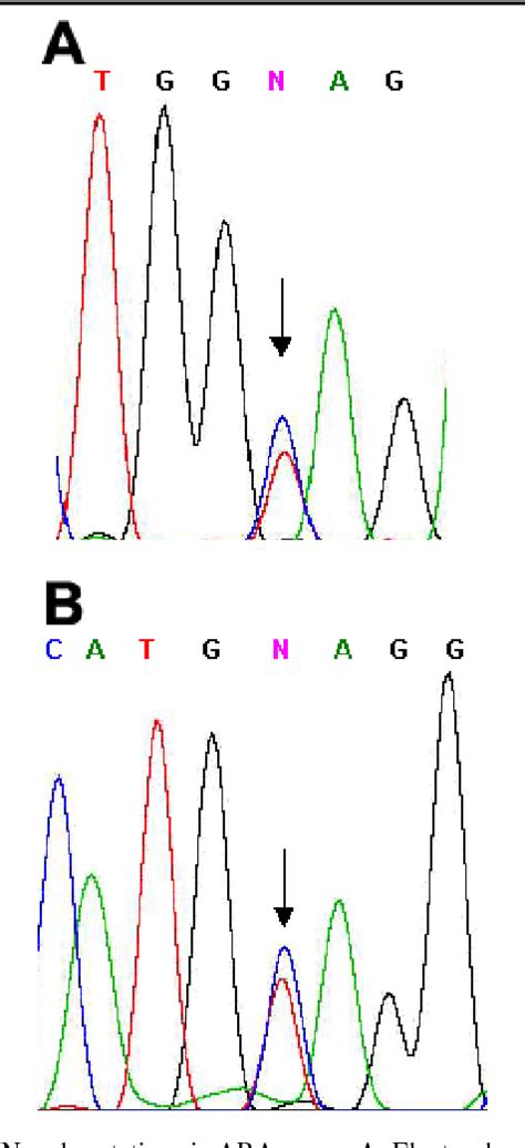 Figure 1 From Mutation Spectrum Of Foxc1 And Clinical Genetic