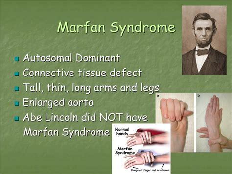 Ppt Genetic Disorders Powerpoint Presentation Free Download Id 6387428