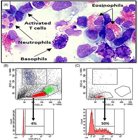 Comprehensive Csf Diagnostic Approach To Investigate Atypical Icans