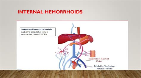 Cirrhosis презентация онлайн