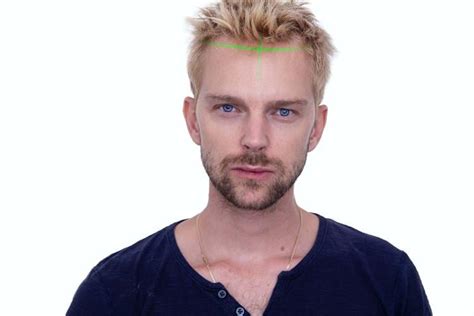2024 Top 10 Best Hair Transplants In Turkey And Costs