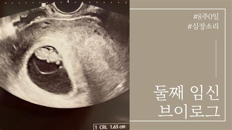 임신브이로그🤰 8주0일 젤리곰 초음파 심장소리 피임고민 산후조리원예약 Youtube
