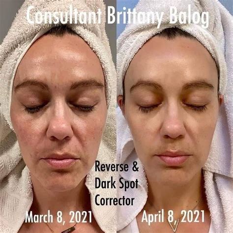 Karen Gates On Twitter Rodan And Fields Dark Spot Corrector Rodan