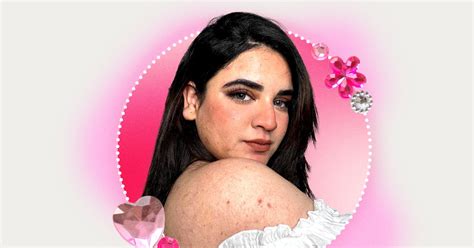 7 Acne Positive Influencers You Should Follow Asap