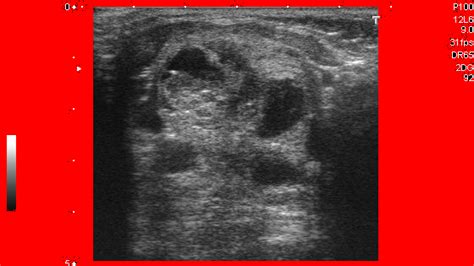 python 3 x crop images with different black margins