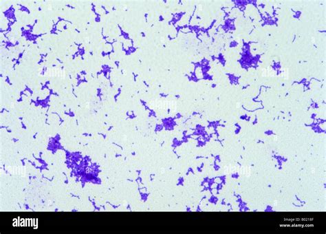 Streptococcus Pyogenes Gram Stain