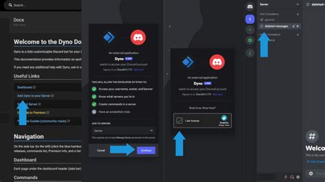 How To See Deleted Messages On Discord 2022 Gadgetgang
