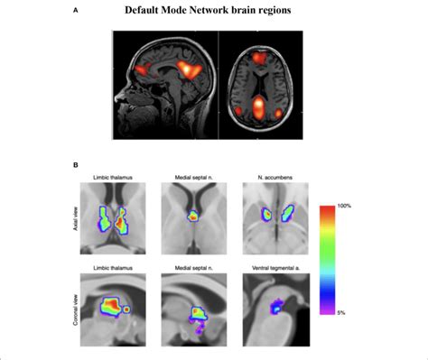 A Functional Mri Demonstration Of The Default Mode Network Dmn