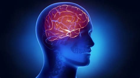 ¿cuál Es La Diferencia Entre Un Derrame Cerebral Y Un Infarto Cerebral