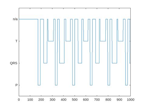 waveform segmentation using deep learning matlab and simulink
