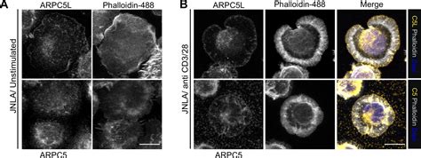 Figures And Data In Arpc5 Isoforms And Their Regulation By Calcium