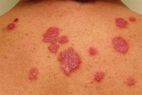 Red Spots On Skin 19 Causes And What They Look Like With Pictures