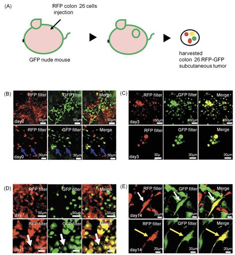 Color Coded Imaging Distinguishes Cancer Cells Stromal Cells And