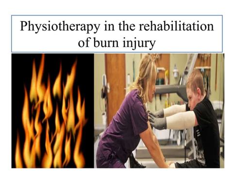 1 Burn Rehablitation Pptx