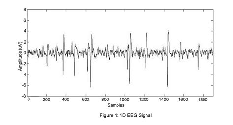 wavelet transform for classification of eeg signal using svm and ann