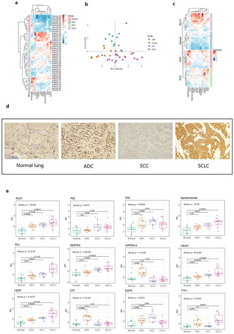 Clustering Analysis Based On 12 Protein Based Rppa Profiling Of Lung