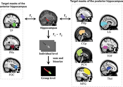 Aberrant Intra‐ And Internetwork Functional Connectivity Patterns Of