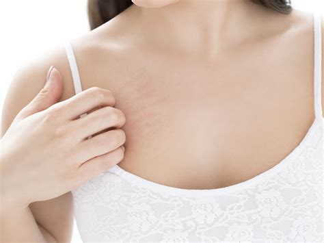 Interpretation Of A Dream About Red Spots On The Breast For A Married