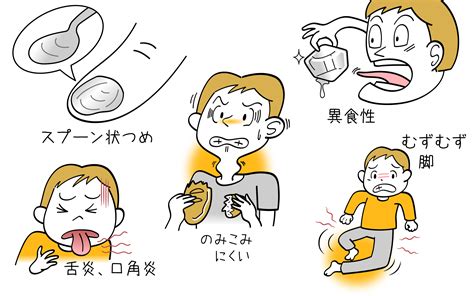 【血液専門医が解説】どうして貧血になるの？貧血の原因と代表的な病気 【上野駅2分】内科・血液内科・糖尿病内科｜上野御徒町こころみクリニック