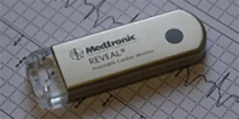 Image result for Loop Recorder Monitoring System