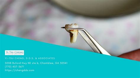 Image result for Infected Tooth Extraction