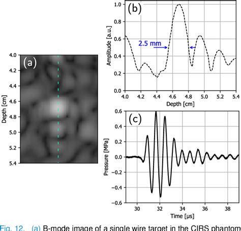 Image result for EPB Ultrasound Linear Array