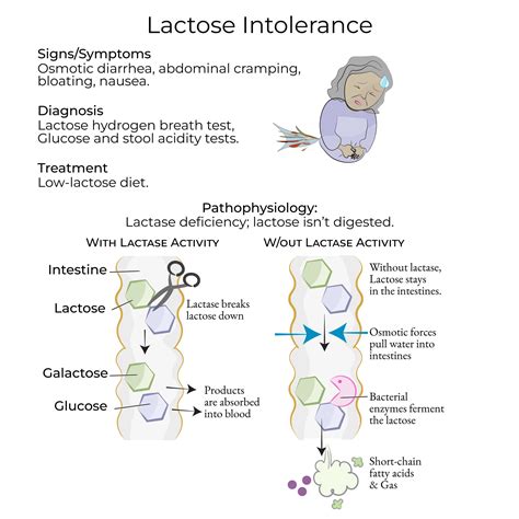 Image result for Lactose Intolerance On Colonoscopy