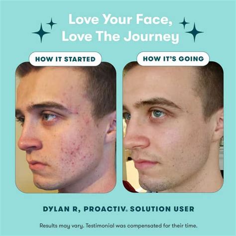 Image result for Proactiv Solution