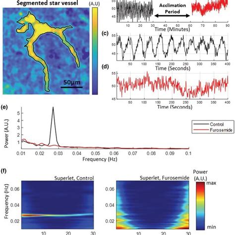 Image result for Spectrogram Decoder