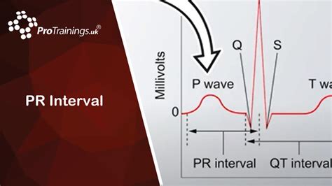 Image result for PR Interval Abnormalities