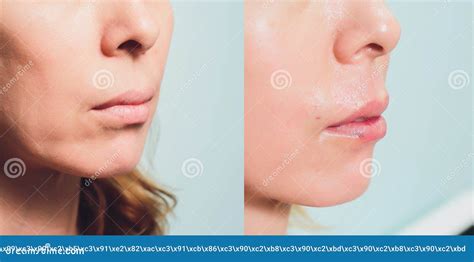 Image result for Upper Lip Threading