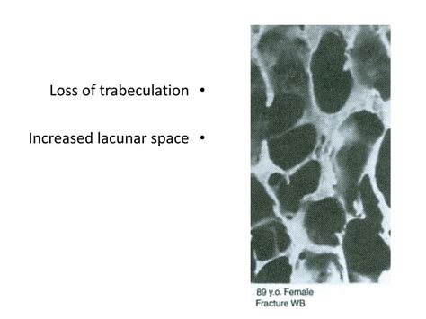 Image result for Normal Bone Formation