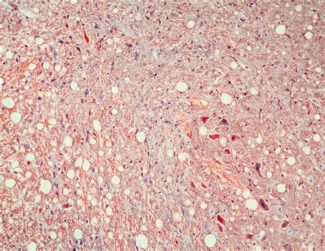 Image result for Cell Cortex