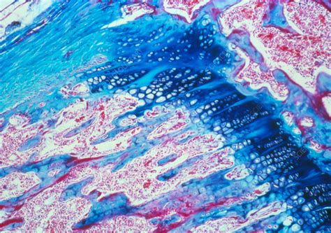 Image result for Normal Bone Formation