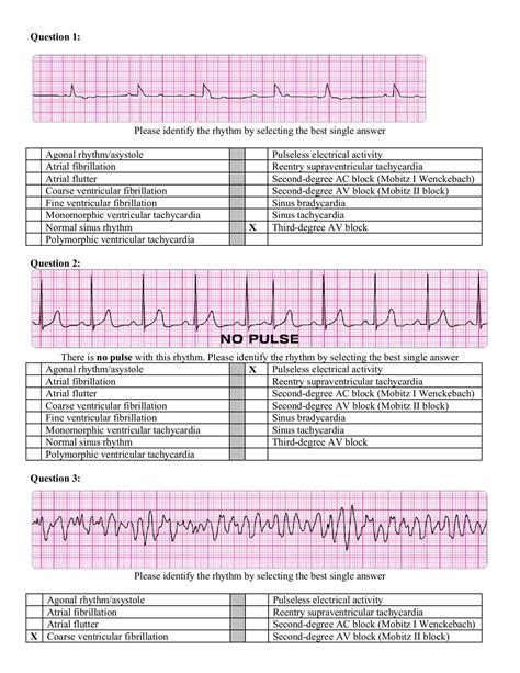 Image result for ACLS Rhythm Test
