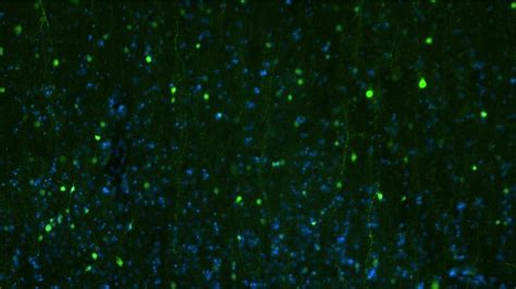 Image result for The Human Brain Map Project