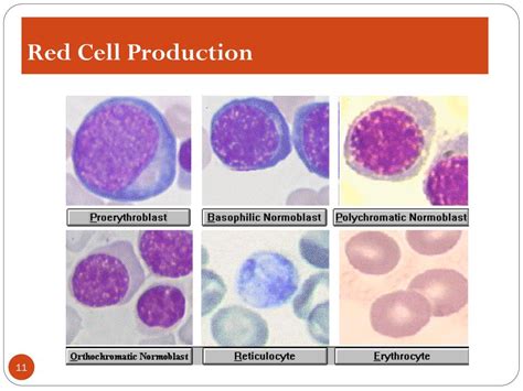 Image result for Disorders of Red Cells Made Simple