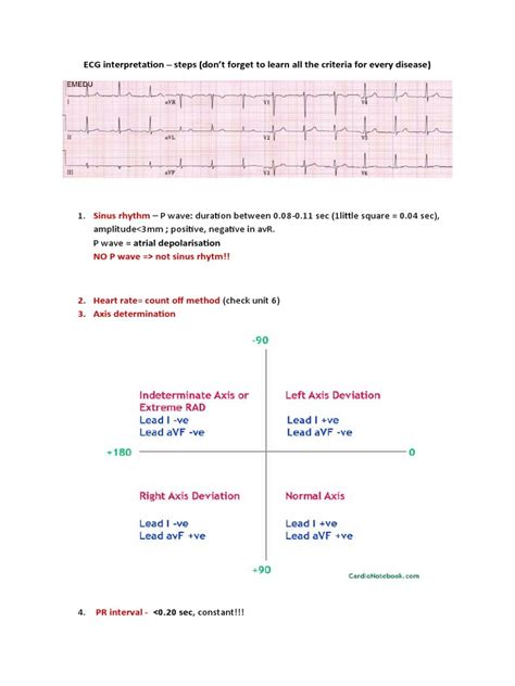 Image result for ECG Step by Step