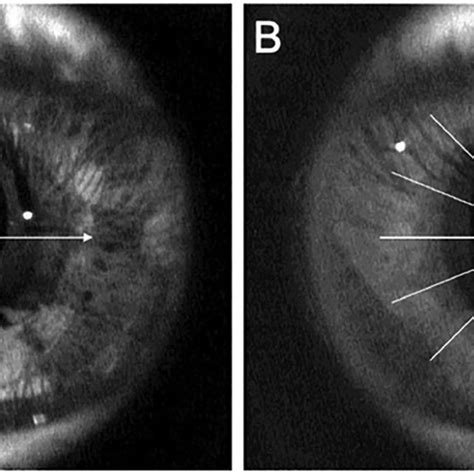 Image result for Oct Line Scan