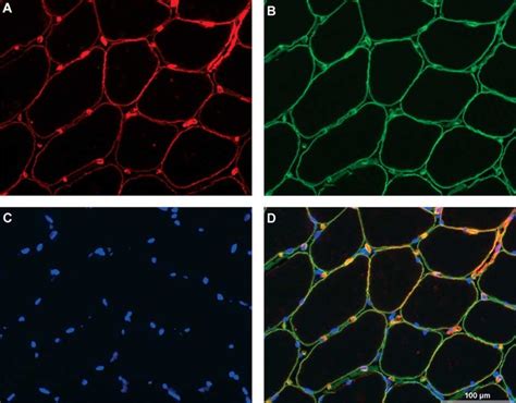 Image result for Field of View Magnification