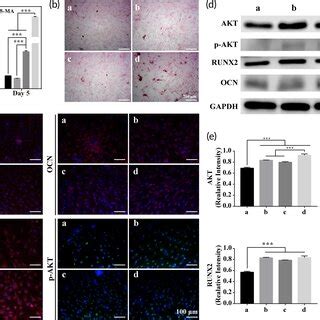 Image result for Bone Formation Signaling Pathway