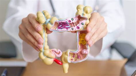 Image result for Colonoscopy Colon Cancer Polyps