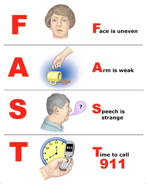 Image result for Fast Stroke