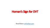 Homan’s Sign for DVT.pptx