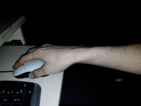 Image result for Can Using a Mouse Cause Arm Pain