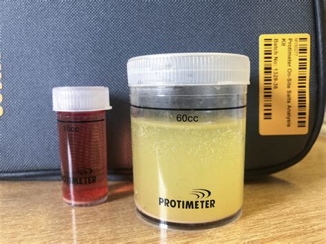 Image result for Salt Preancy Test