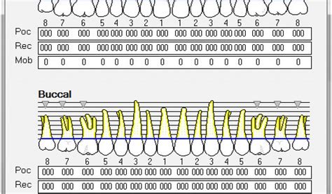 Image result for Downloadable Perio Chart